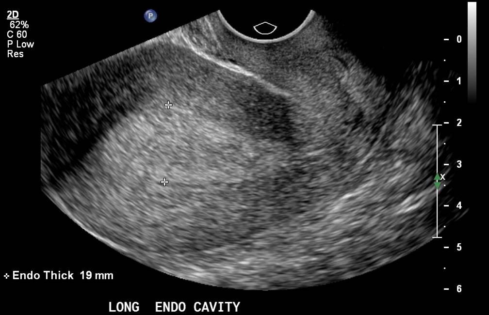 Help support the development of ultrasound services | SoR