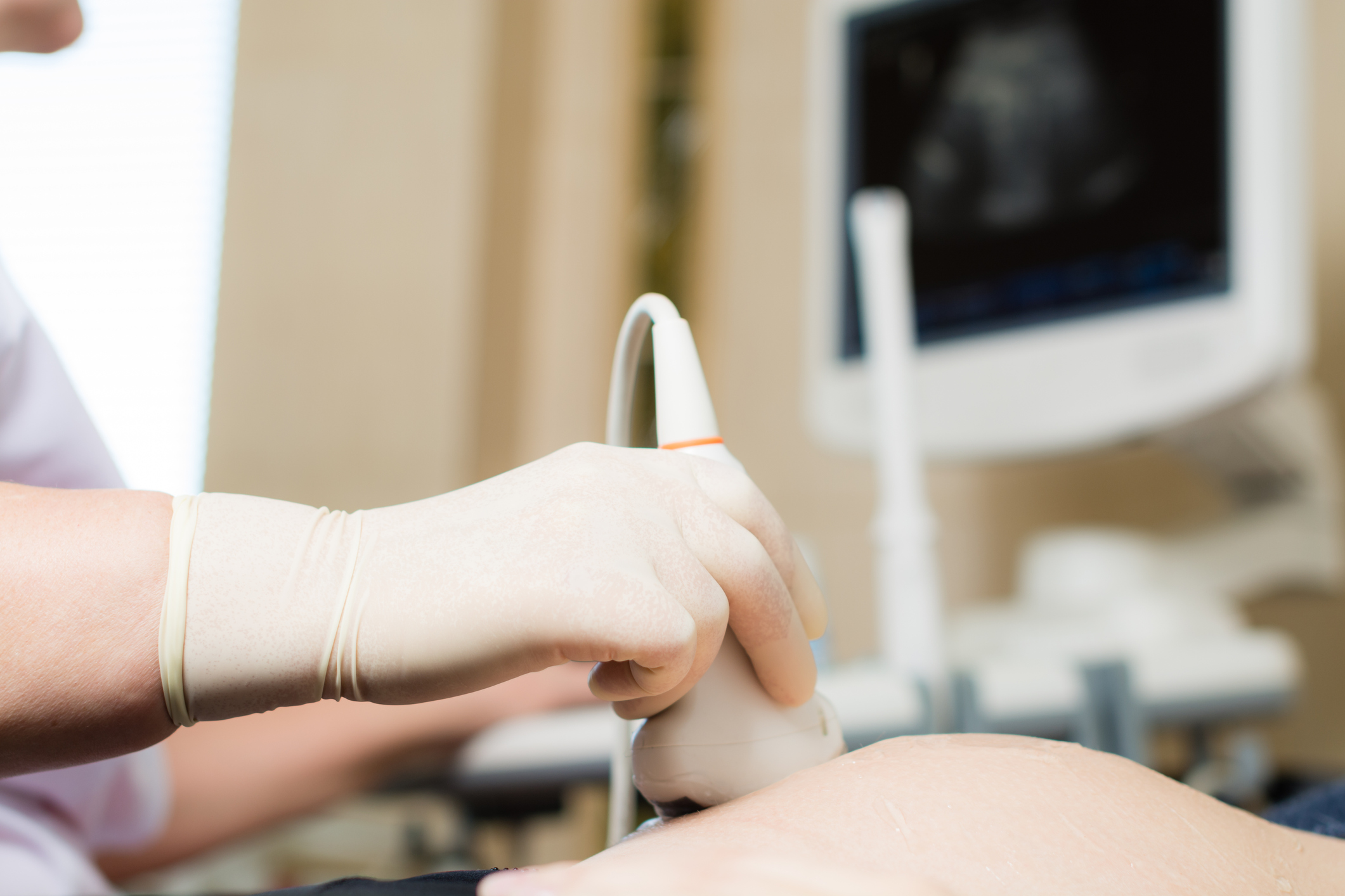 New national guidance on partners attending antenatal scans | SoR