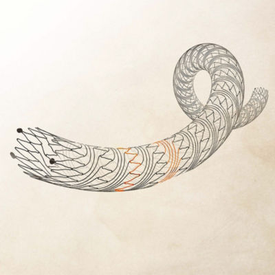 Revised instructions for MRI compatibility of stents | SoR