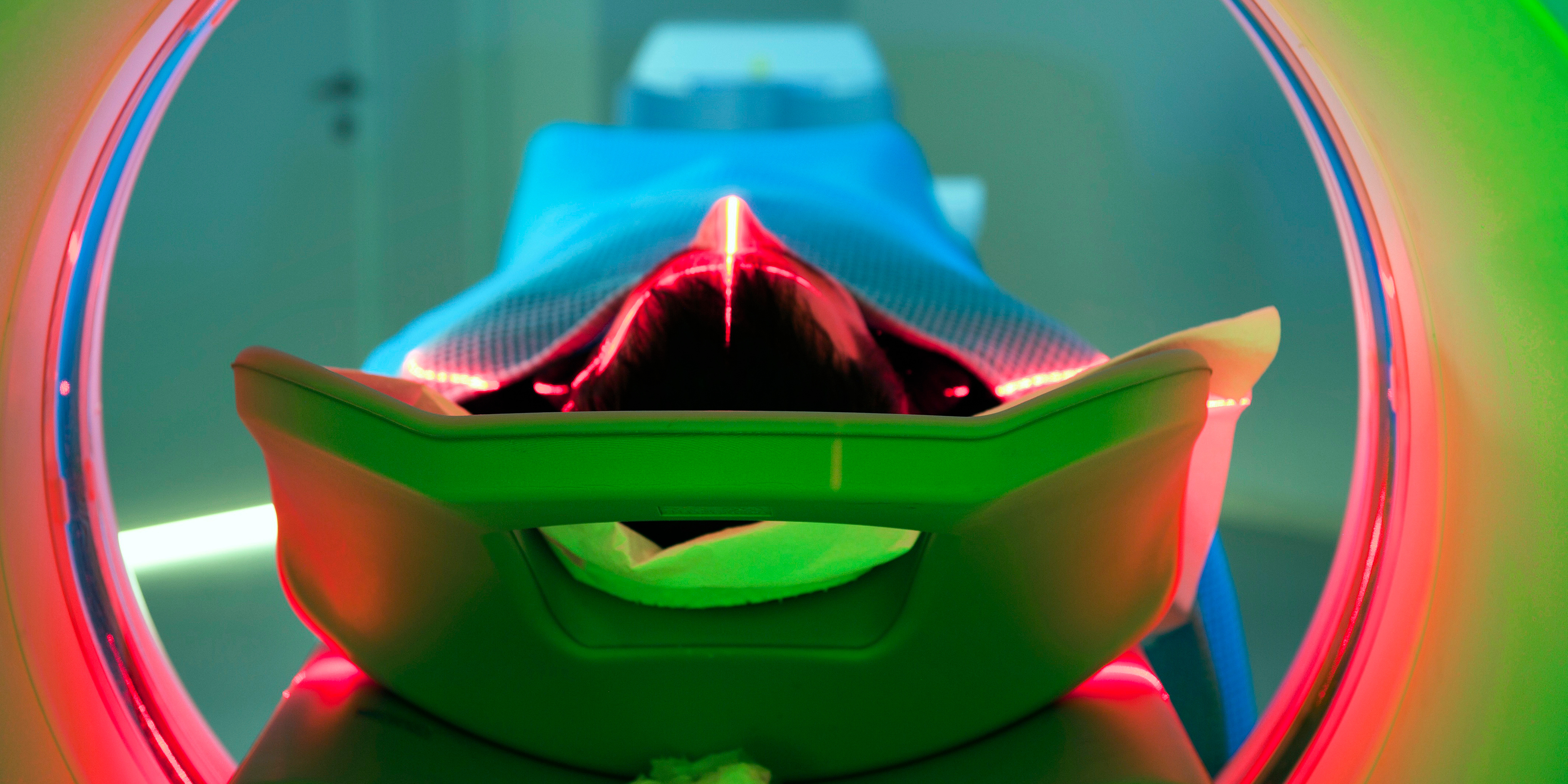 Royal College of Radiologists opens consultation on auto-contouring in ...