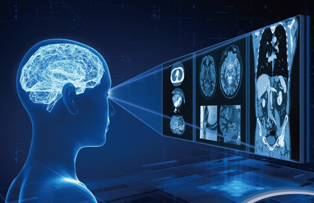 How the rise of AI-assisted CT will help transform clinical procedures ...