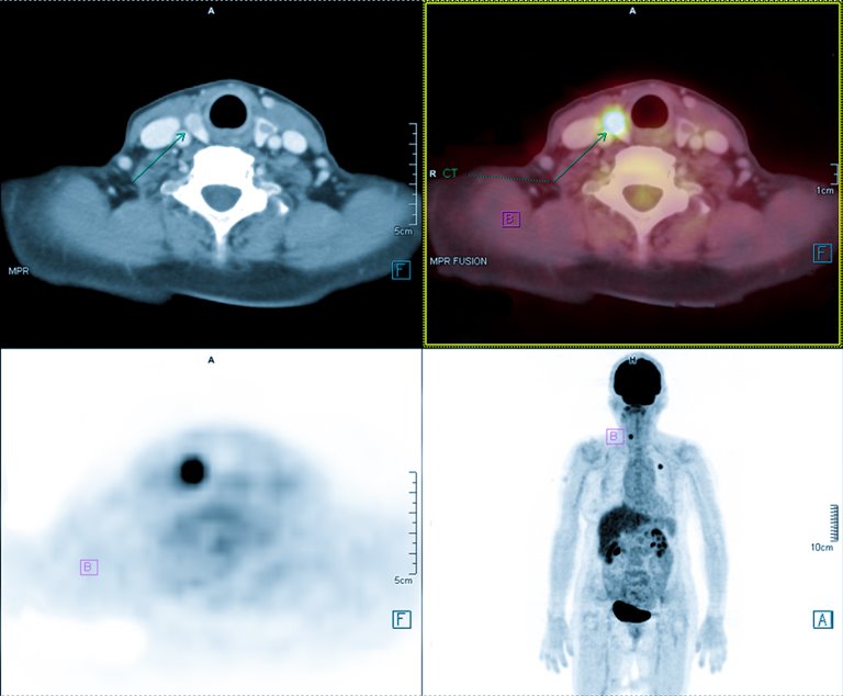 Call for proffered posters | SoR