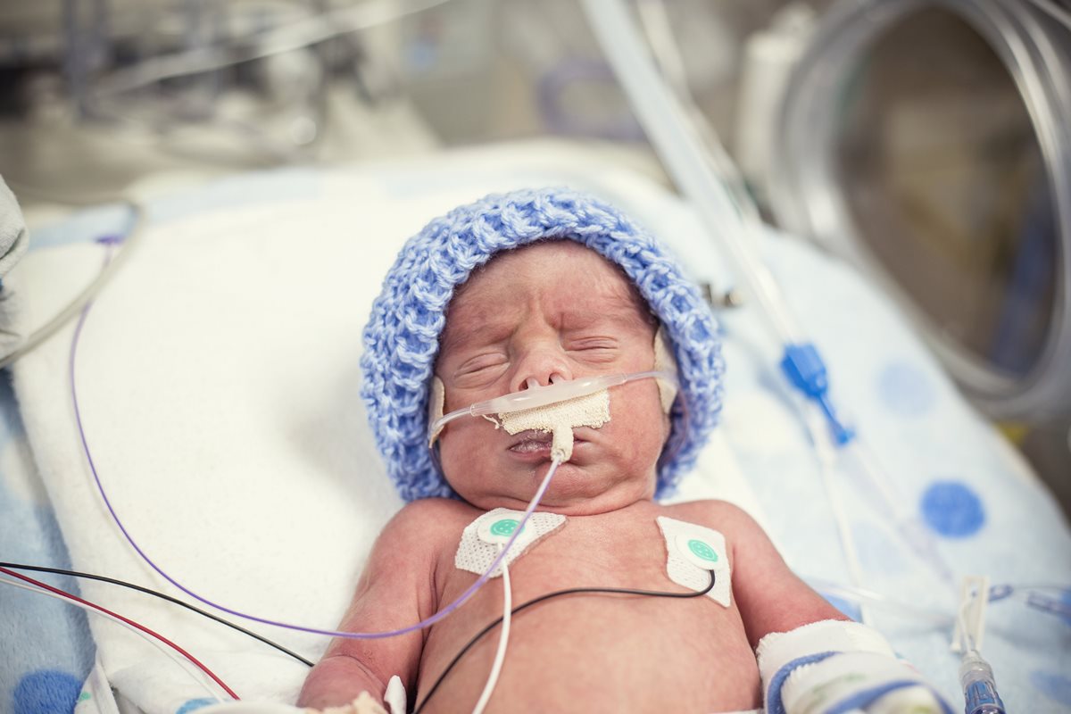 Reducing Perinatal Mortality Sor