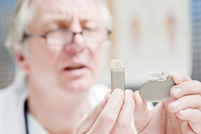 MRI Safety Week: Should we be scanning pacemakers in MRI? - Getting to ...